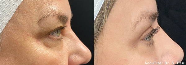 AccuTite NYC | Dr. Edward Kwak