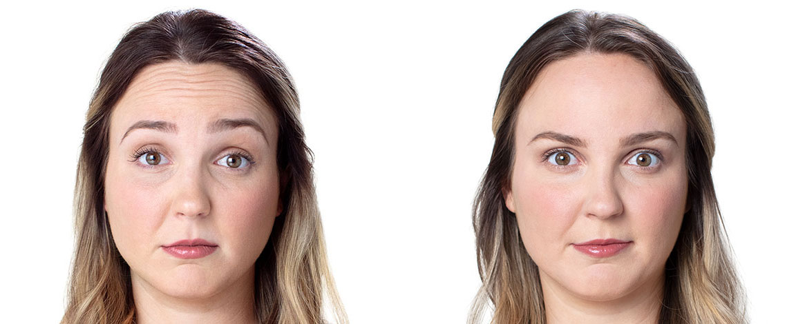 Botox NYC | Dysport & Botox New York City